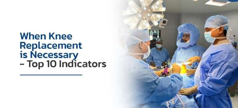 When Knee Replacement is Necessary - Top 10 Indicators